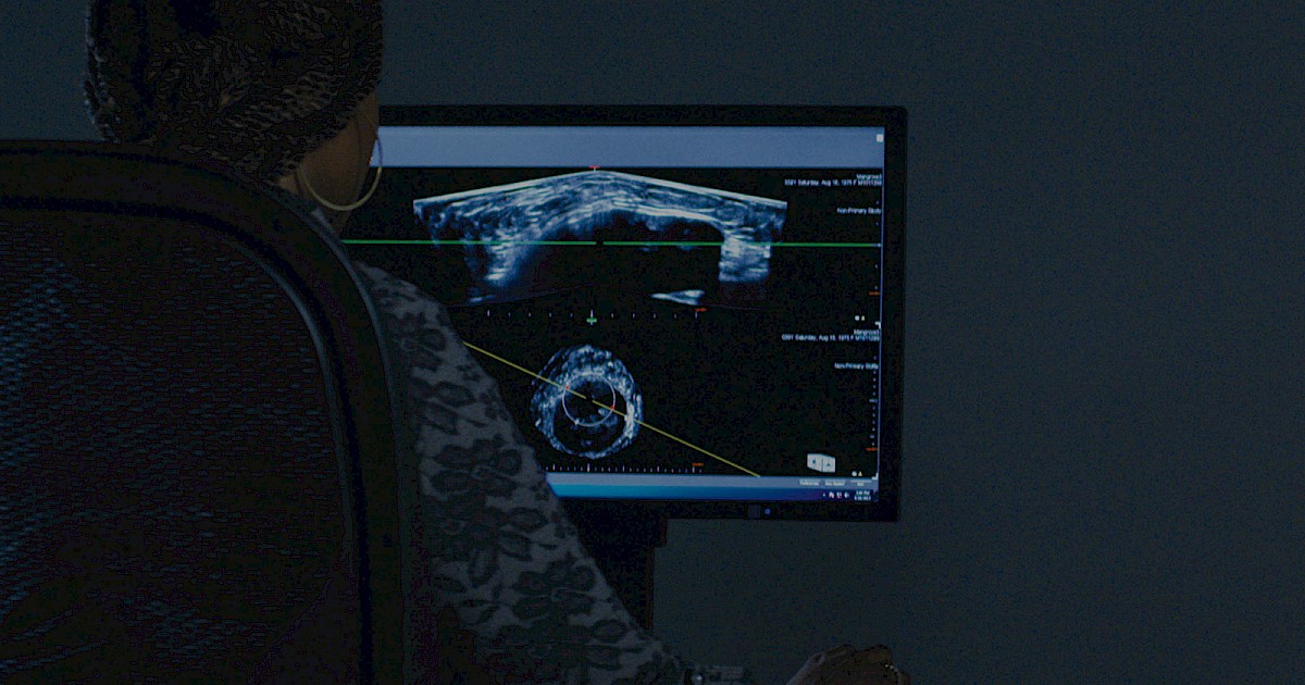 Repositioning Hitachi Healthcare Americas | SFA Marketing